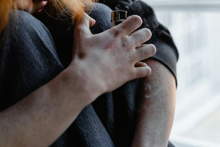 Which Fabrics Help Prevent Skin Irritation and Rashes? - Knowing Fabric