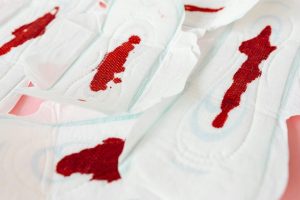 Blood Stain on a Wool Rug, How to Remove - Knowing Fabric
