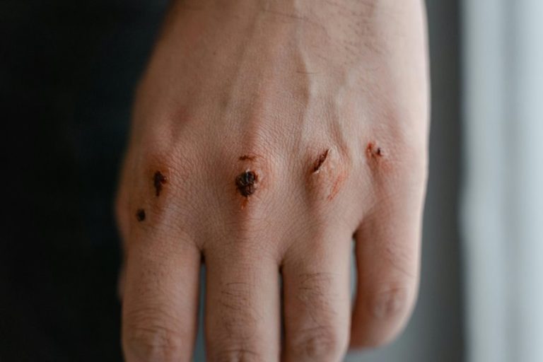 Is Polyamide Safe For Skin - Knowing Fabric